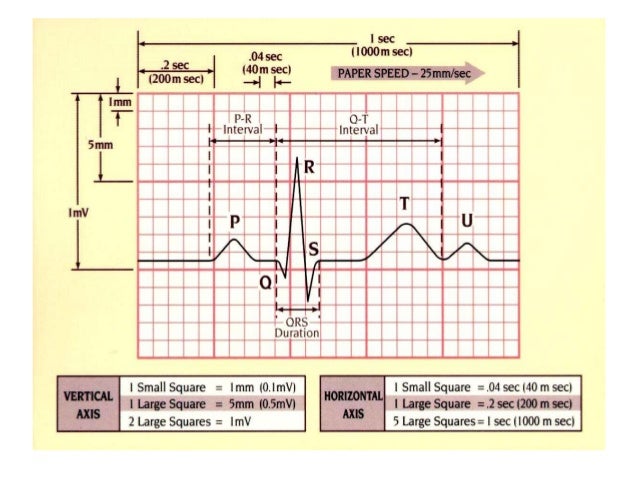ECG easy way