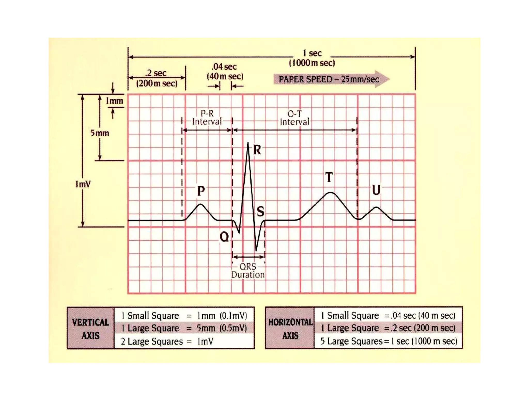 All About ECG | PDF | Heart and Cardiovascular Diseases | Diseases and ...