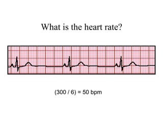 All About ECG | PDF