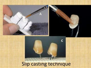 All ceramic-restoration | PPTX