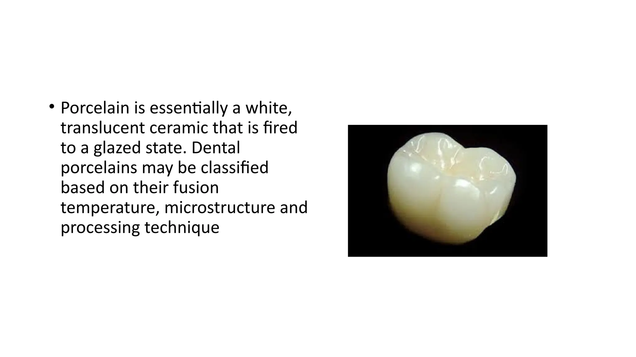All-Ceramic Crowns and Bridges in fpd.pptx
