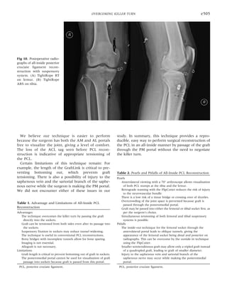 All inside posterior cruciate ligament killer turm | PDF