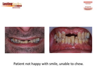 All on-four larry henry | PPT