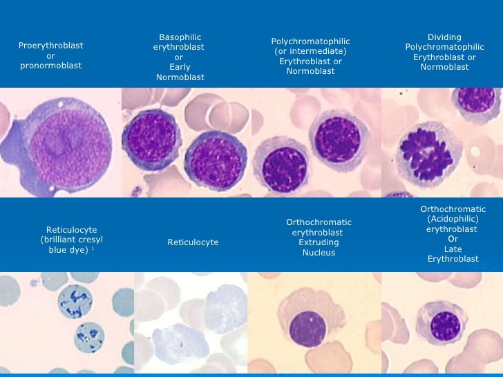 Flashcards - Chapter 8: Erythropoeisis and destruction