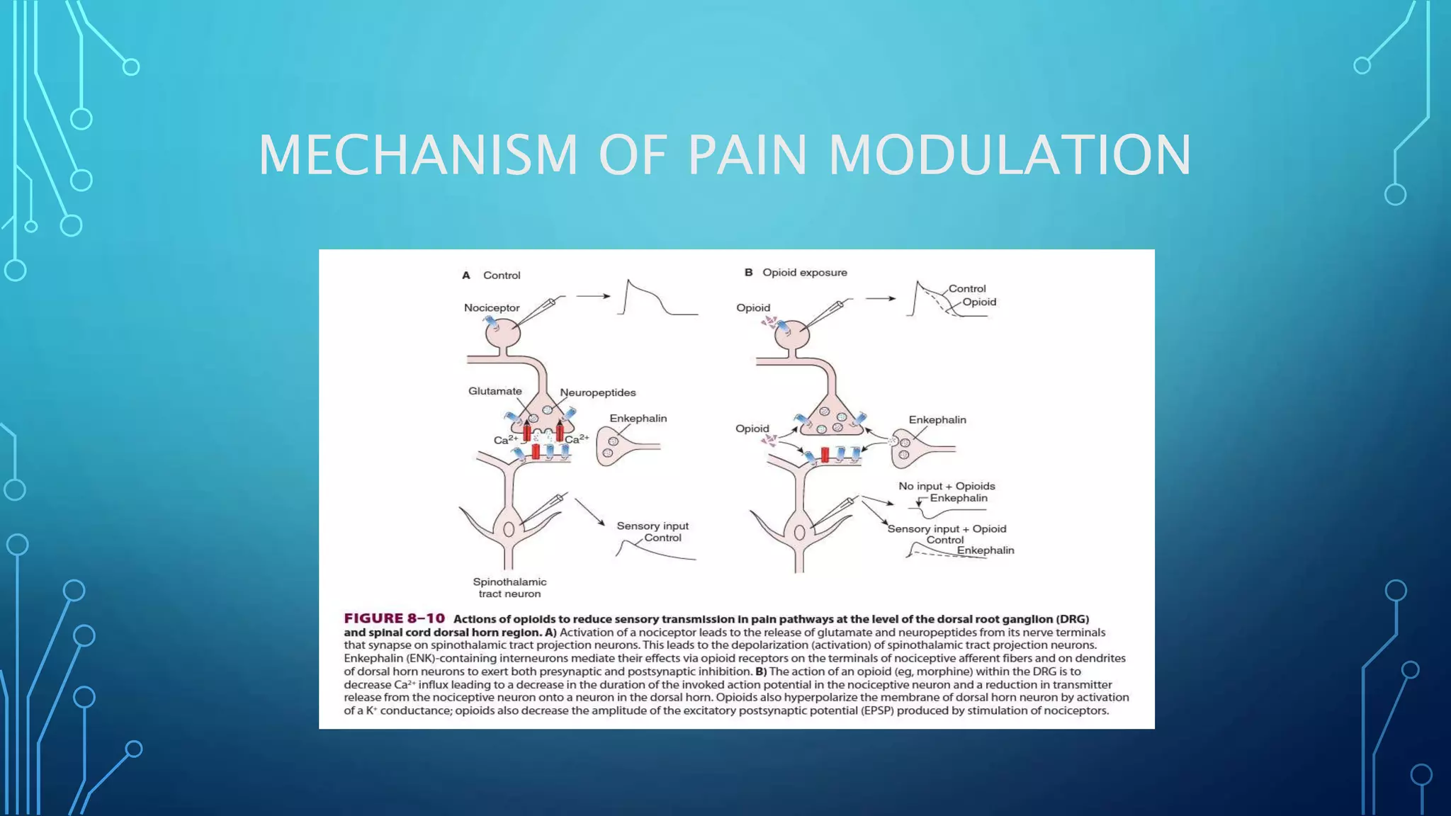 pain physiology , pathology, types , assessment, management , recent advances | PPTX