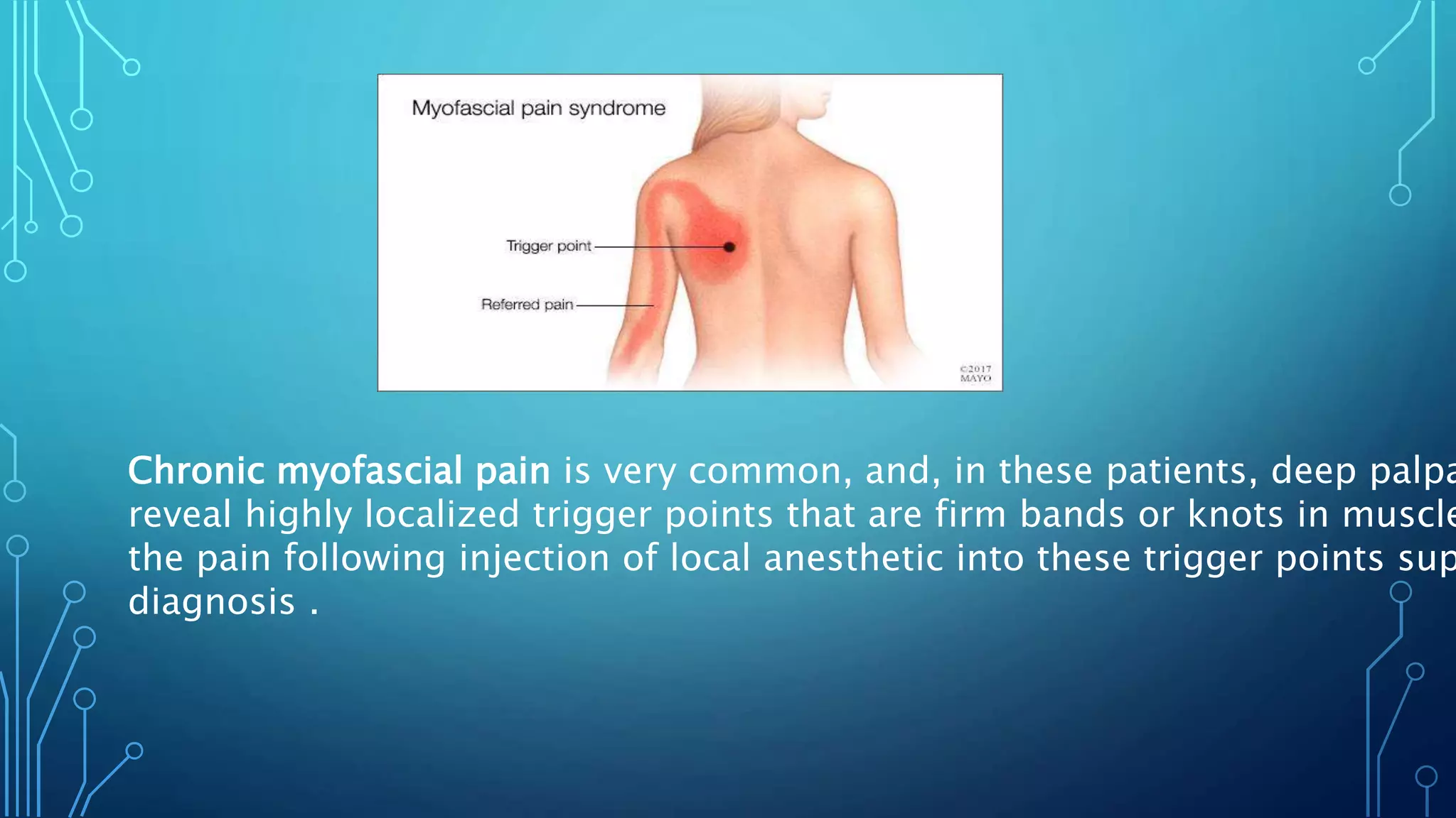 pain physiology , pathology, types , assessment, management , recent ...