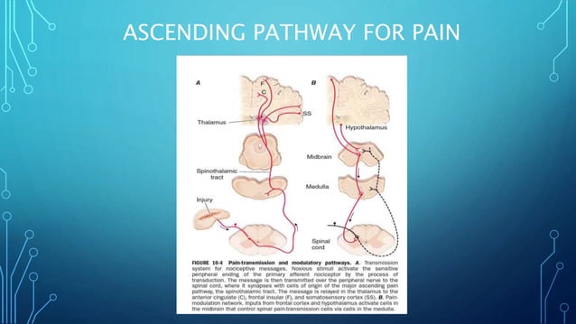 pain physiology , pathology, types , assessment, management , recent ...