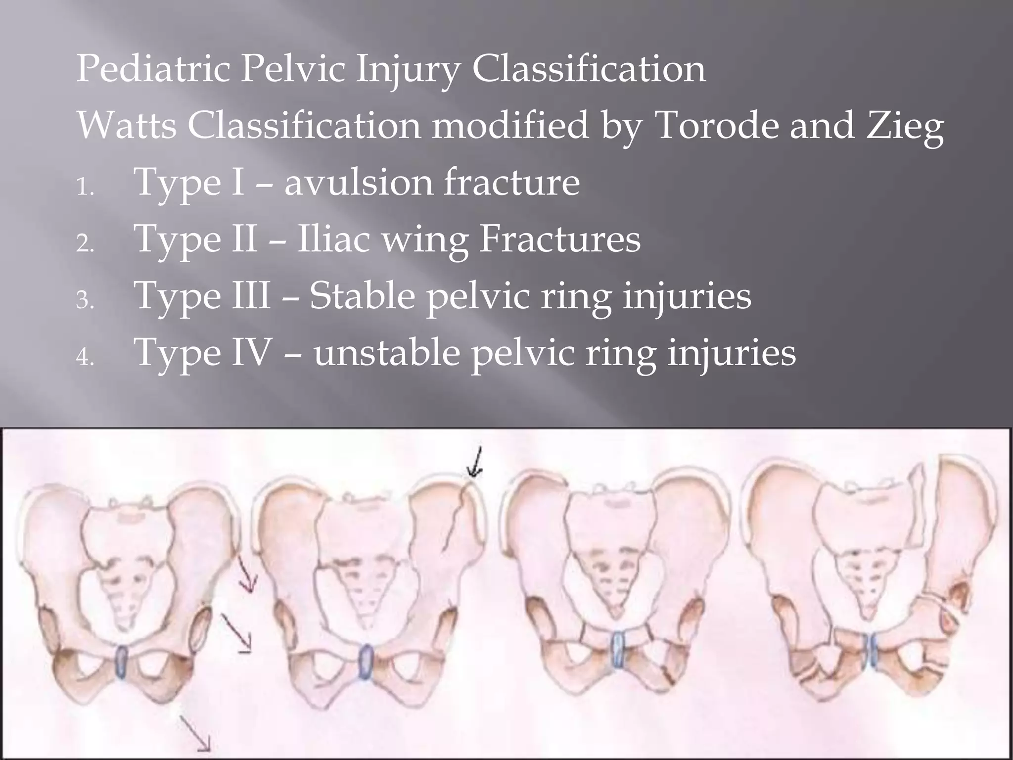 All about pelvic | PPTX