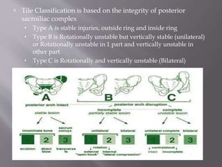 All about pelvic | PPTX