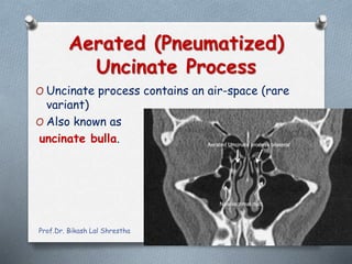 All about uncinate process of nose and paranasal sinuses | PPTX