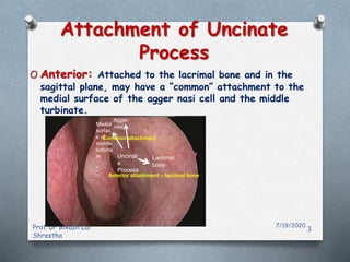 All about uncinate process of nose and paranasal sinuses PPT