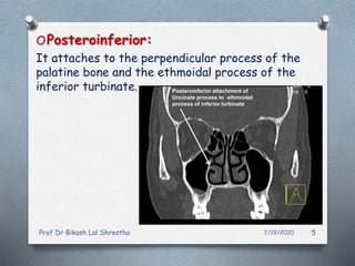 All about uncinate process of nose and paranasal sinuses | PPTX