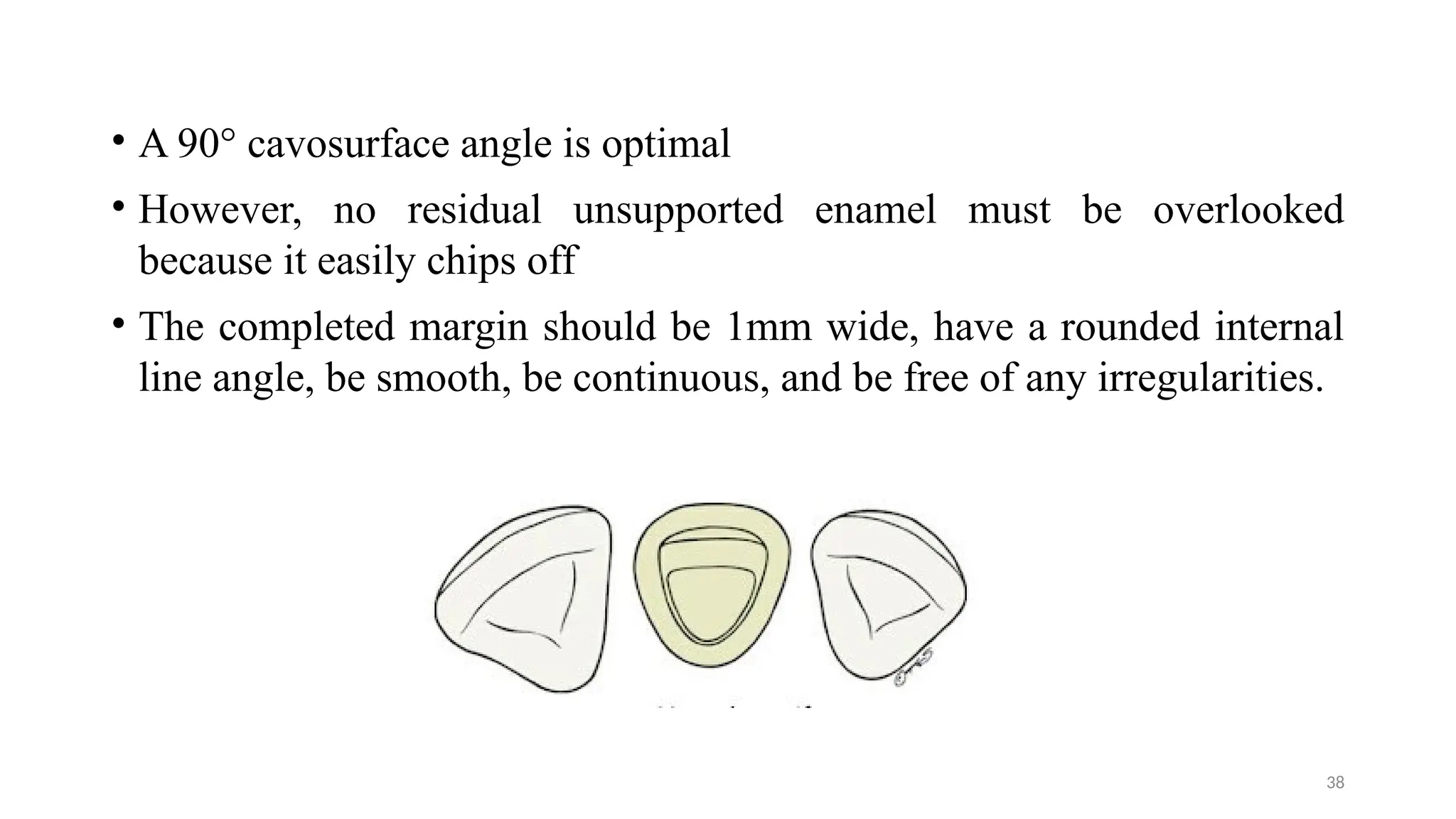 All ceramic crown preparation and cemantation | PPTX