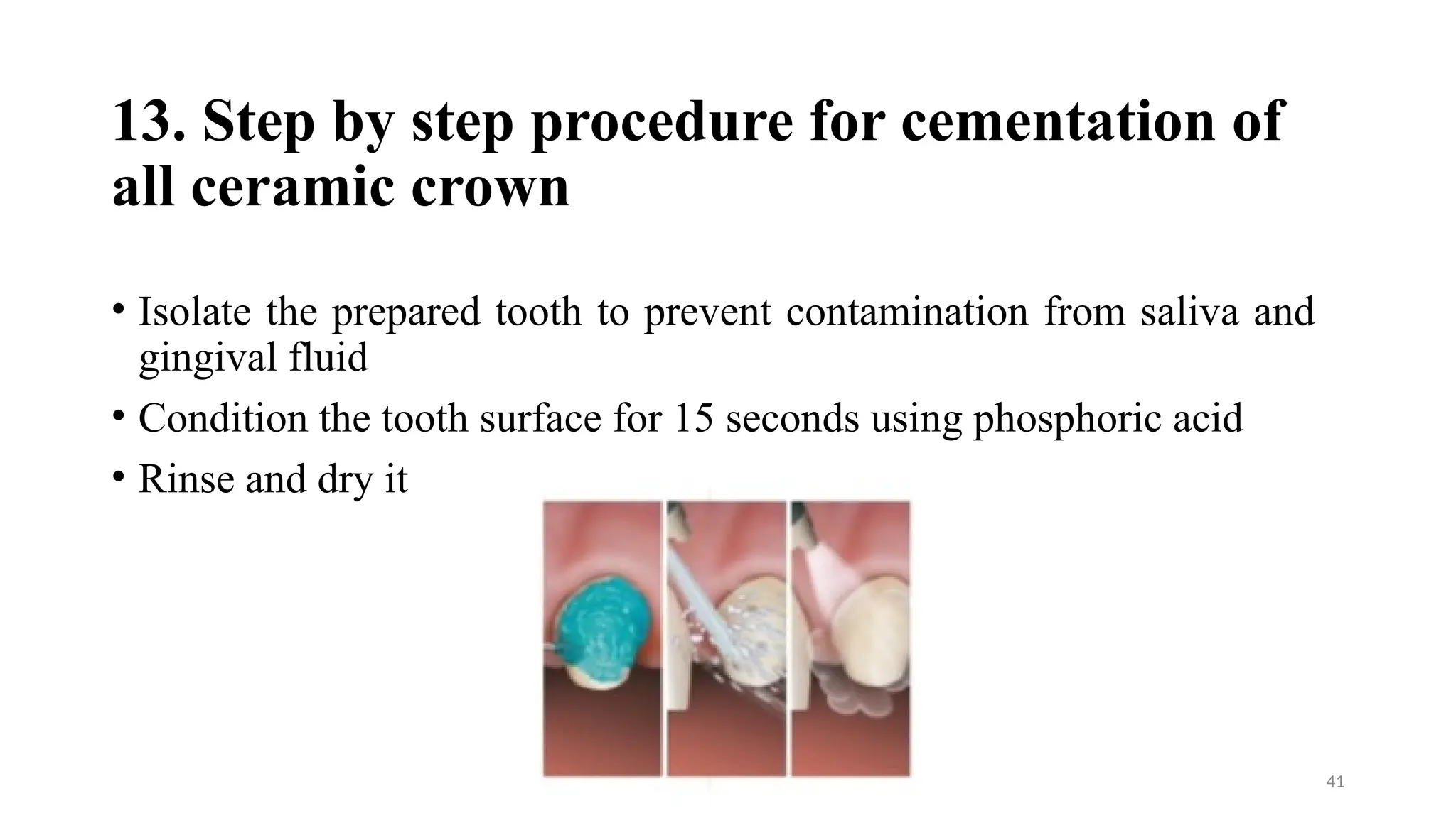 All ceramic crown preparation and cemantation | PPTX