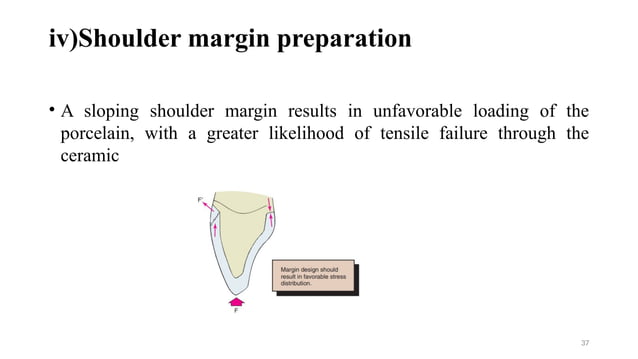 All ceramic crown preparation and cemantation | PPT