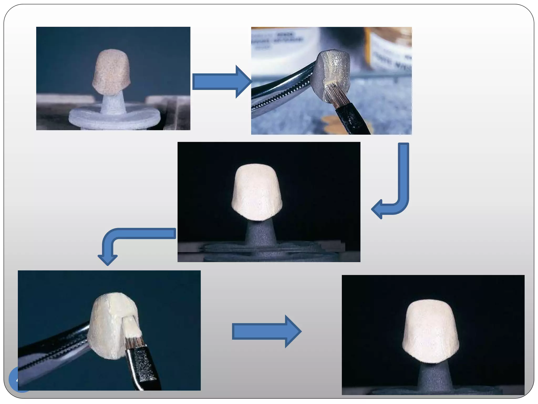 All ceramic materials | PPTX | Dental Health | Diseases and Conditions