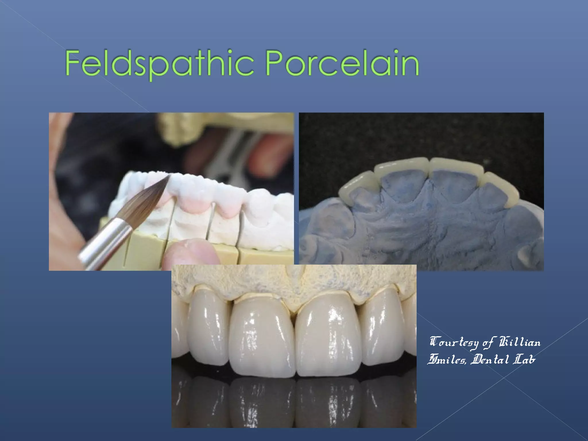 All Ceramic Restorations | PPT