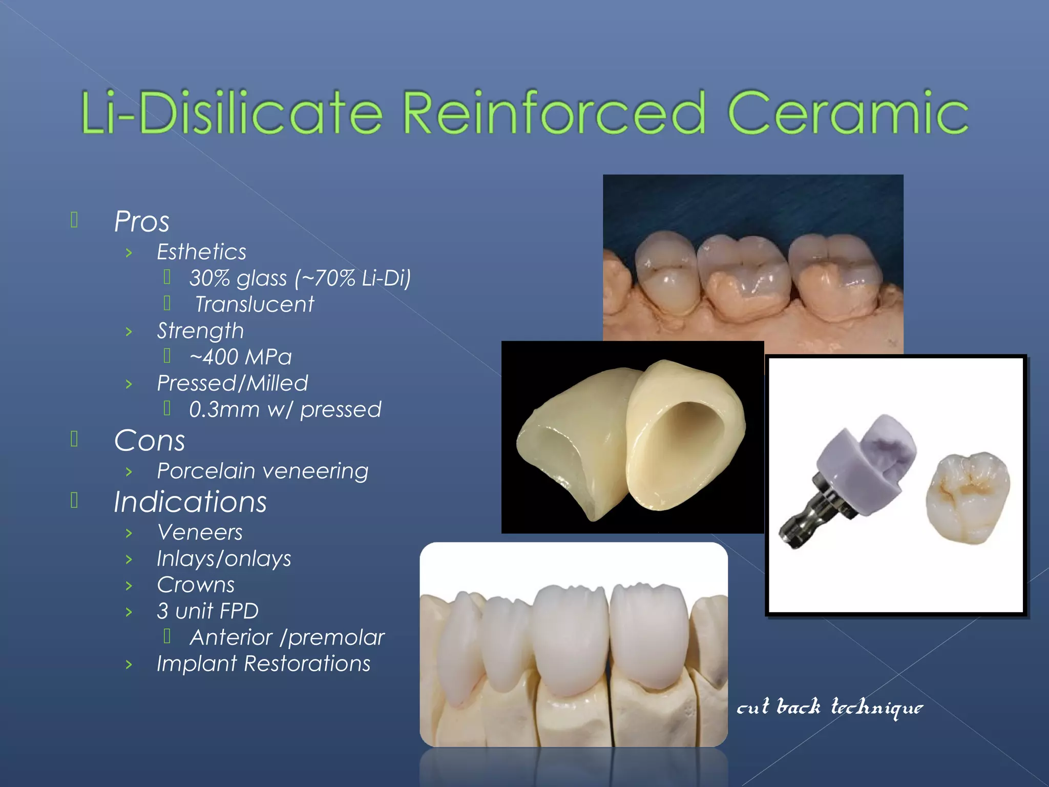 All Ceramic Restorations | PPT