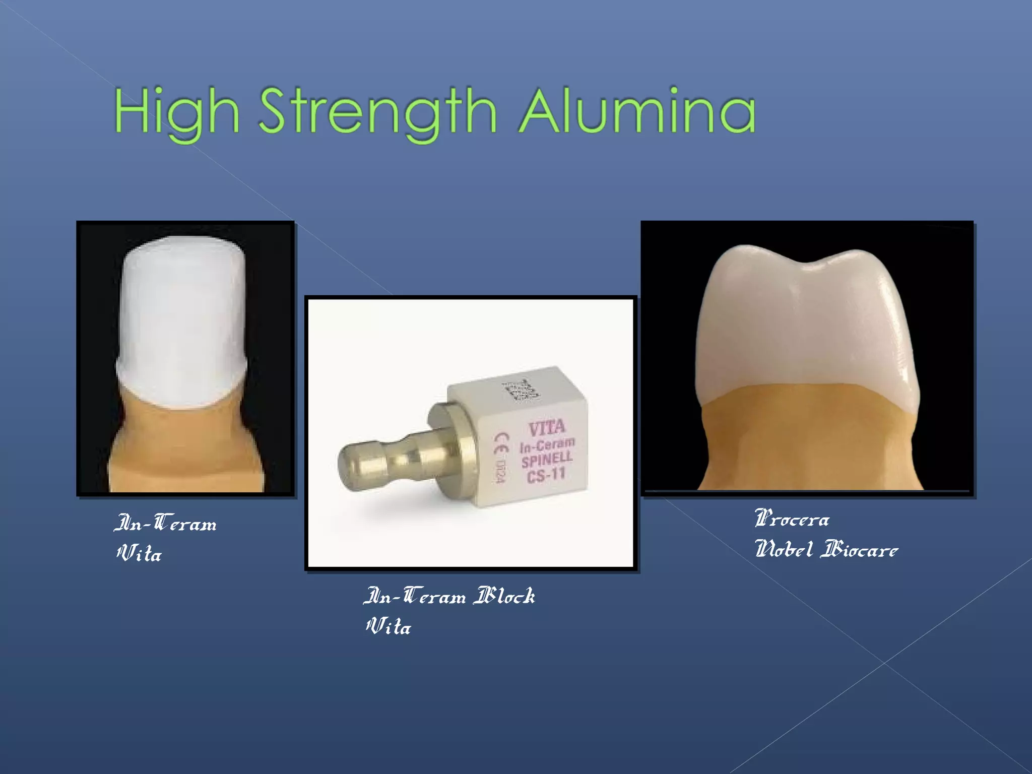 All Ceramic Restorations | PPT
