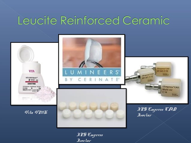 All Ceramic Restorations | PPT | Dental Health | Diseases and Conditions