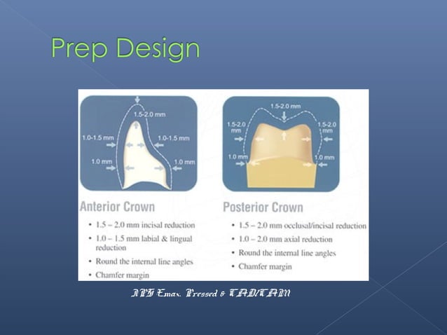 All Ceramic Restorations | PPT | Dental Health | Diseases and Conditions
