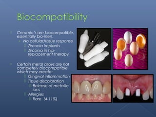 All Ceramic Restorations | PPT