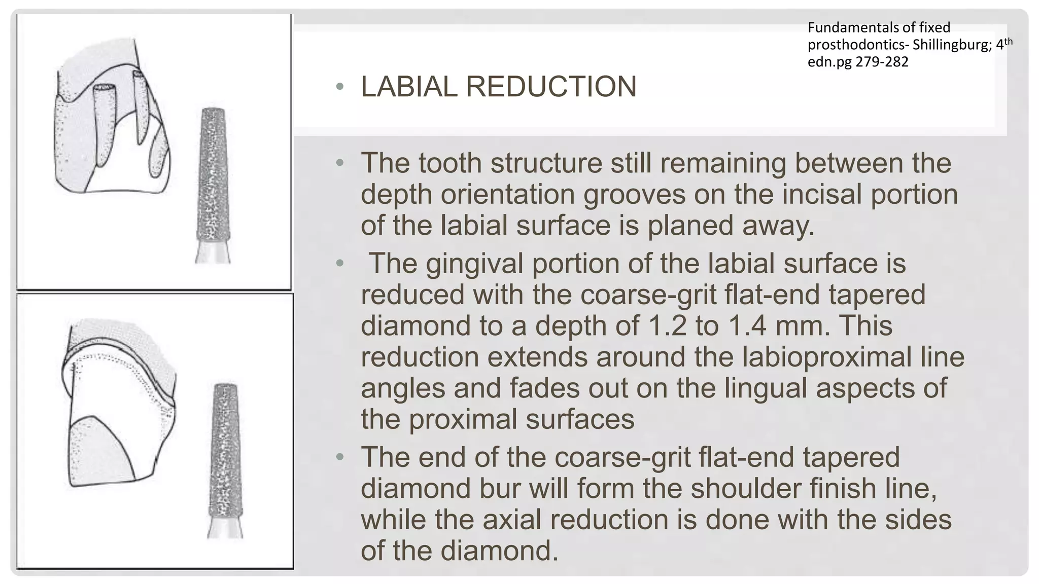 All ceramic restorations | PPTX