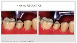 All ceramic restorations | PPTX