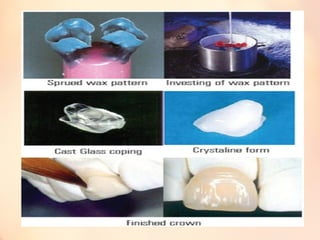 ALL CERAMICS : Advancements, Applications, and Benefits.pptx