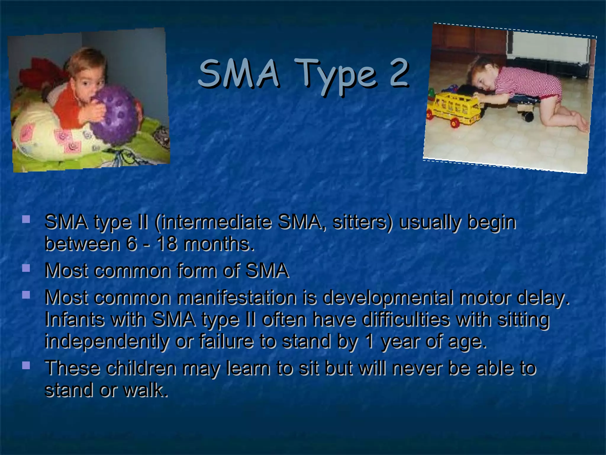 spinal muscular atrophy sma by allelieh | PPT