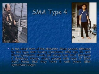 spinal muscular atrophy sma by allelieh | PPT