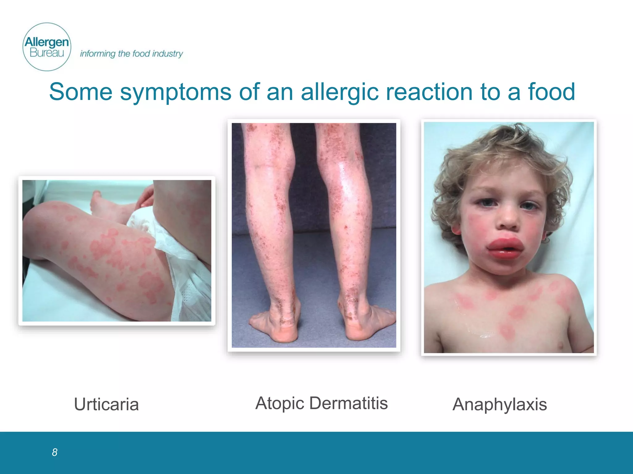 Allergen Training | PDF