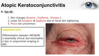 Allergic conjuctivitis | PPTX