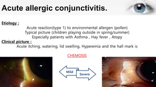 Allergic conjuctivitis | PPTX