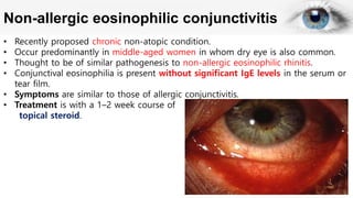 Allergic conjuctivitis | PPTX
