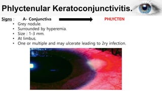 Allergic conjuctivitis | PPTX