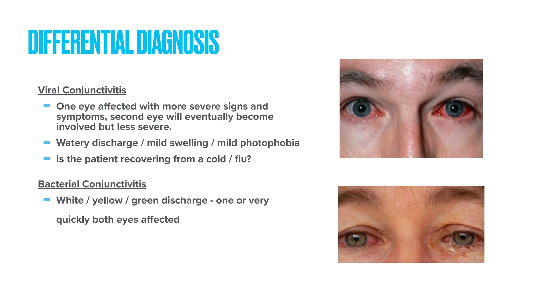 allergic-conjunctivitis Dr. Book for allergic conjunctivitis.pdf