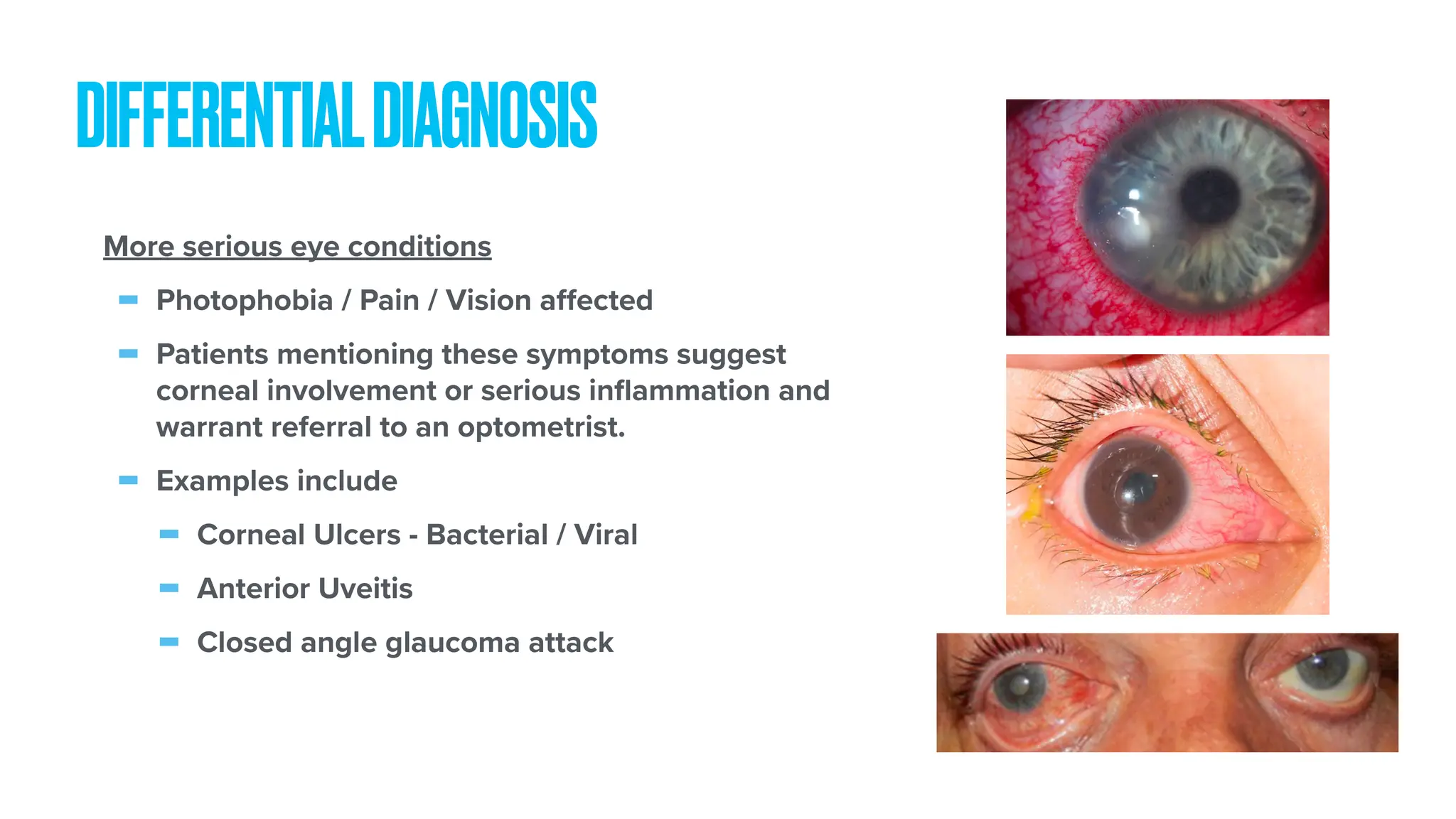allergic-conjunctivitis Dr. Book for allergic conjunctivitis.pdf