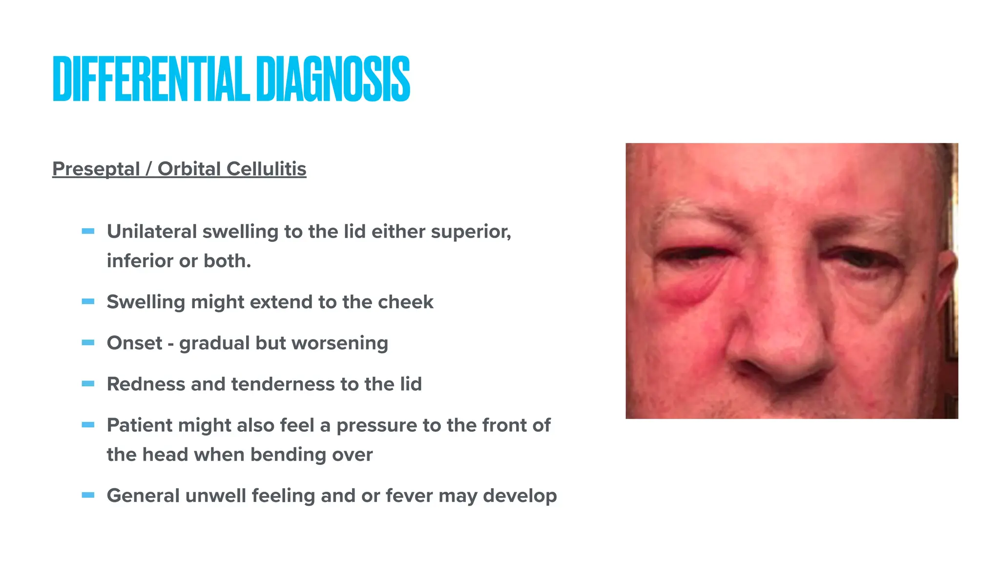 allergic-conjunctivitis Dr. Book for allergic conjunctivitis.pdf