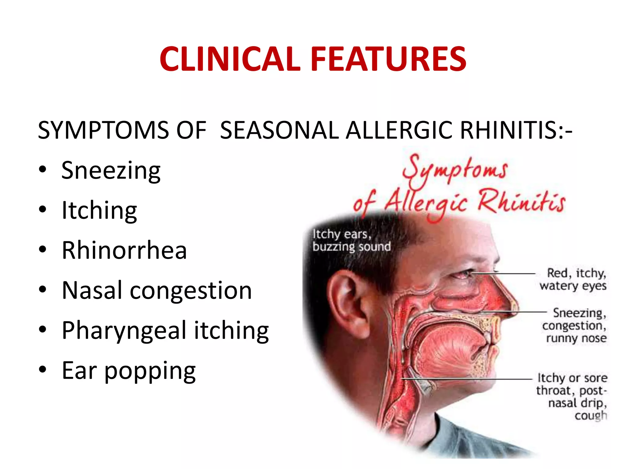 Allergic rhinitis | PPTX