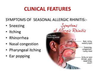 Allergic rhinitis | PPTX