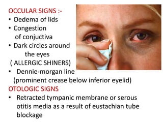 Allergic rhinitis | PPTX