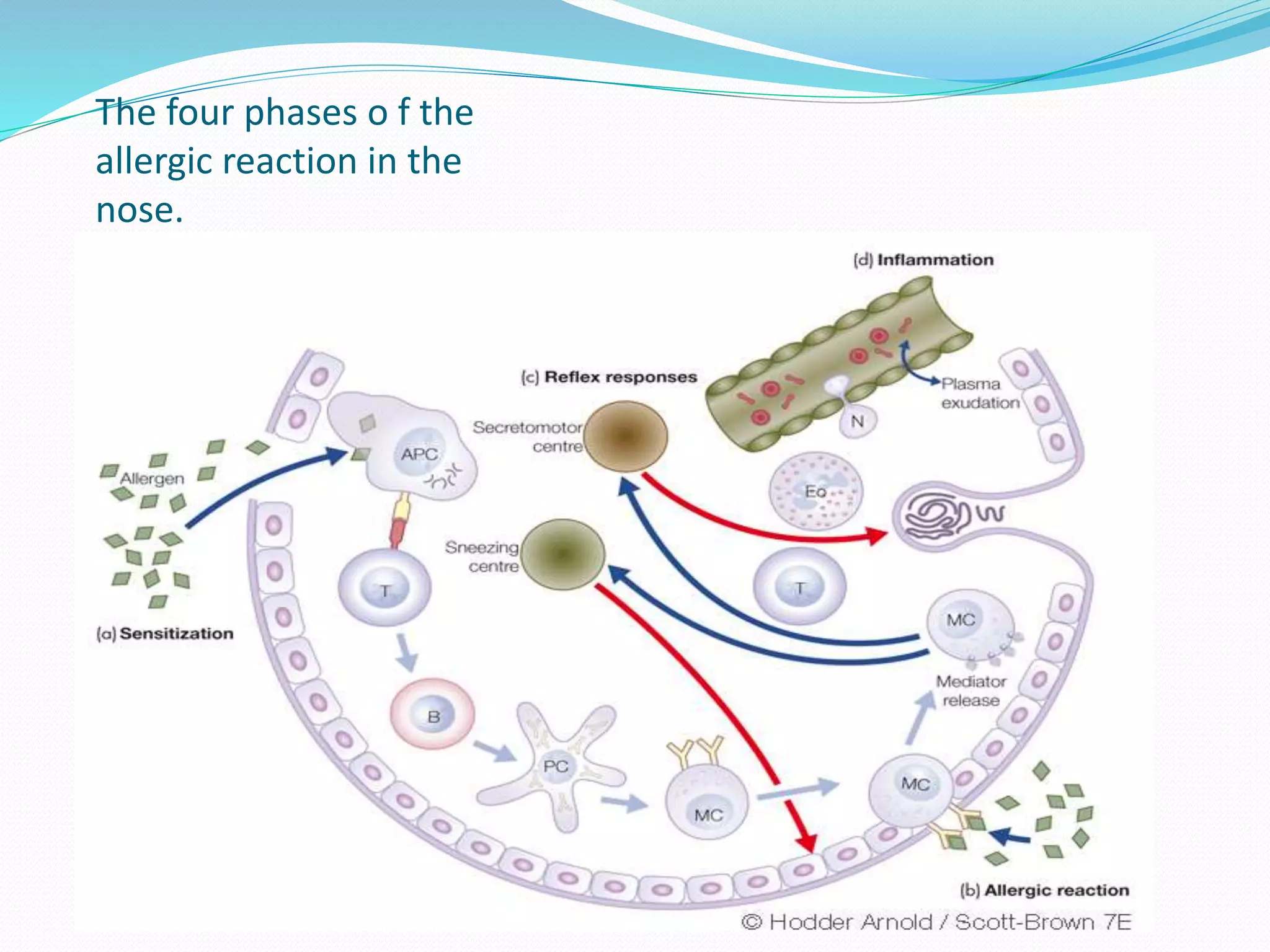 Allergic and non allergic rhinitis | PPTX