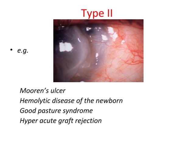 ALLERGY AND HYPERSENSITIVITY: PERRENIAL CONJUNCTIVITIS, VERNAL ...