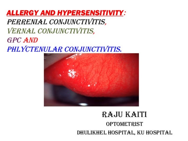 Follicular Vs Papillary Conjunctivitis