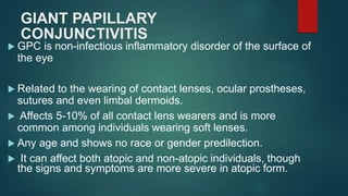 Allergic Conjunctivitis - Dr Arnav Saroya | PPTX