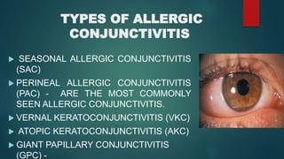 Allergic Conjunctivitis - Dr Arnav Saroya | PPTX