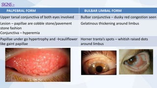 Allergic conjuctivitis - vijayendra | PPT