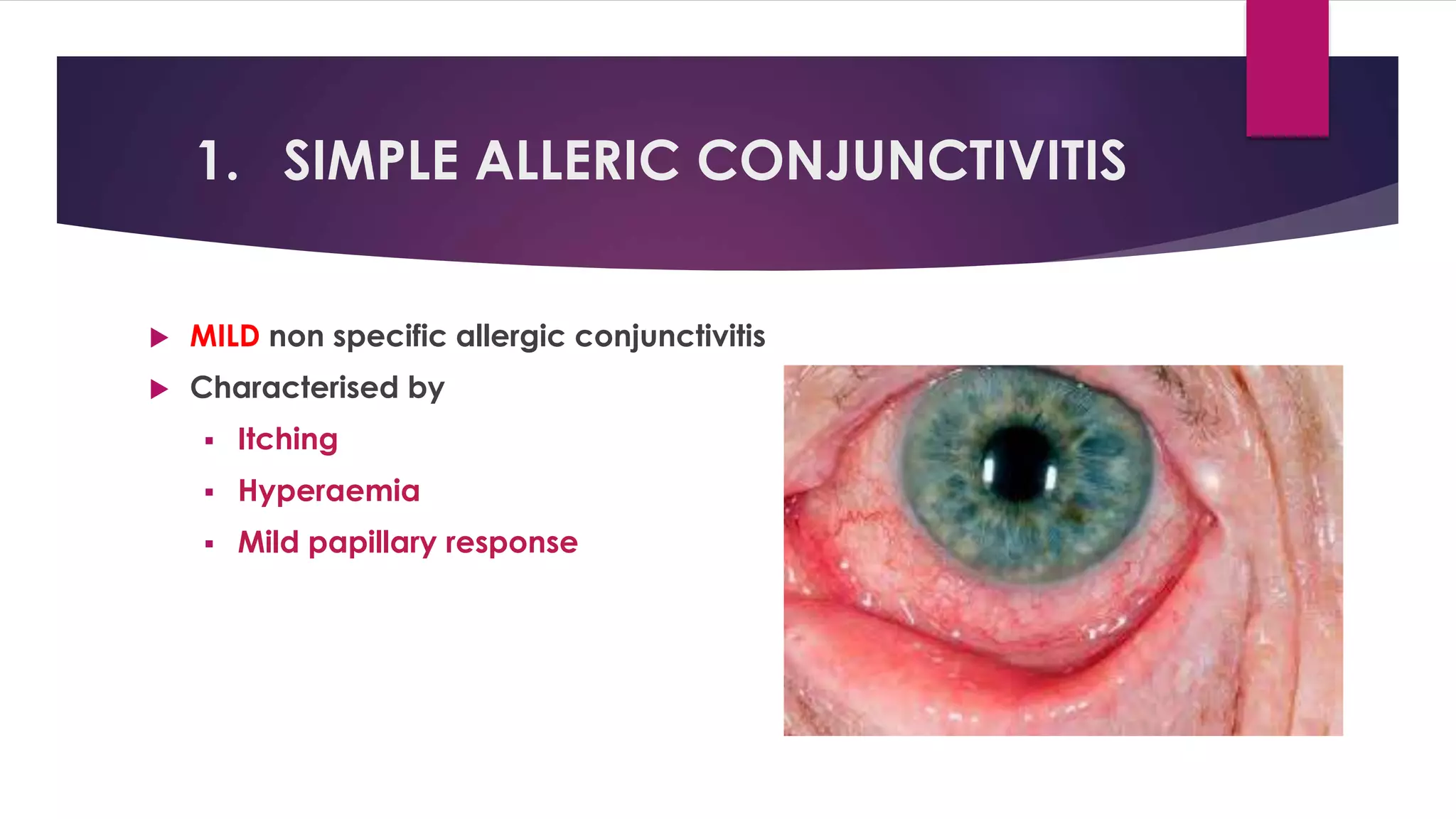 Allergic conjuncticitis | PPTX