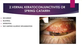 Allergic conjuncticitis | PPT